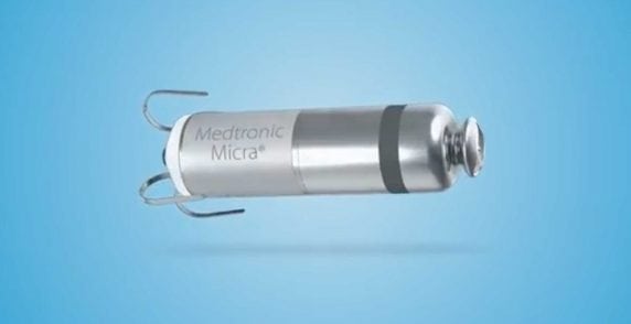 The World's Smallest Pacemaker - Health News Hub