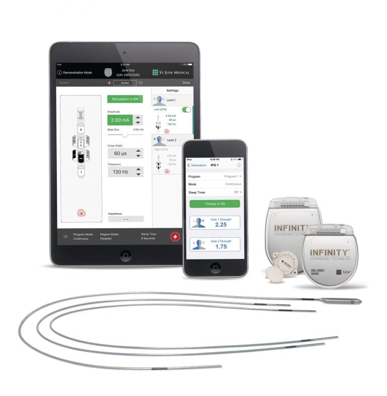 Parkinson's: New, App-Controlled Deep Brain Stimulation Technology ...