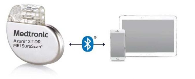 Bluetooth Technology in a Pacemaker - Health News Hub