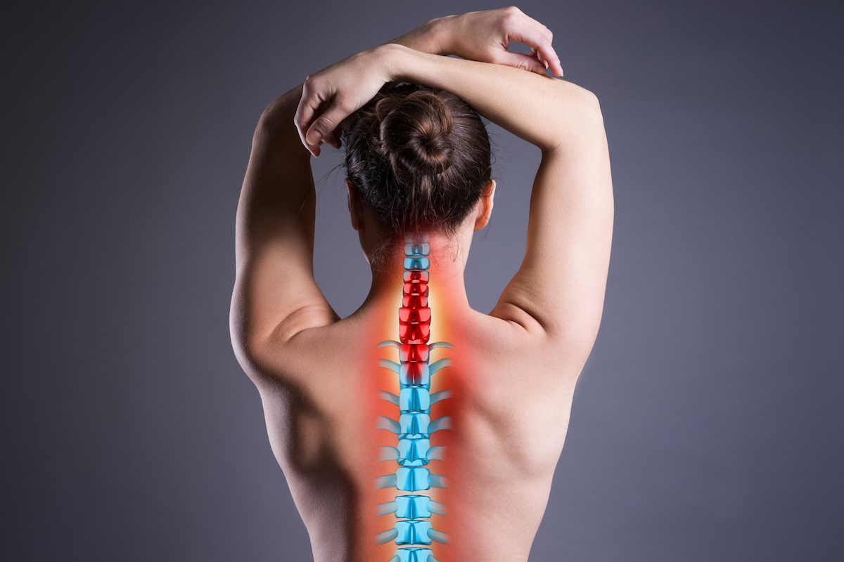 Surgeon New Lumbar Implant To Change The Way We Do Spine Surgery