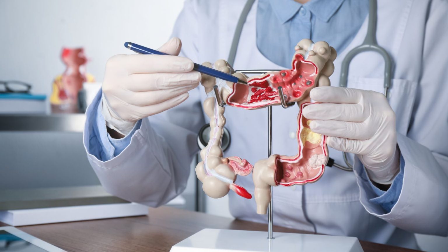 4 Ways to Screen for Colon Cancer Without a Colonoscopy - Health News Hub